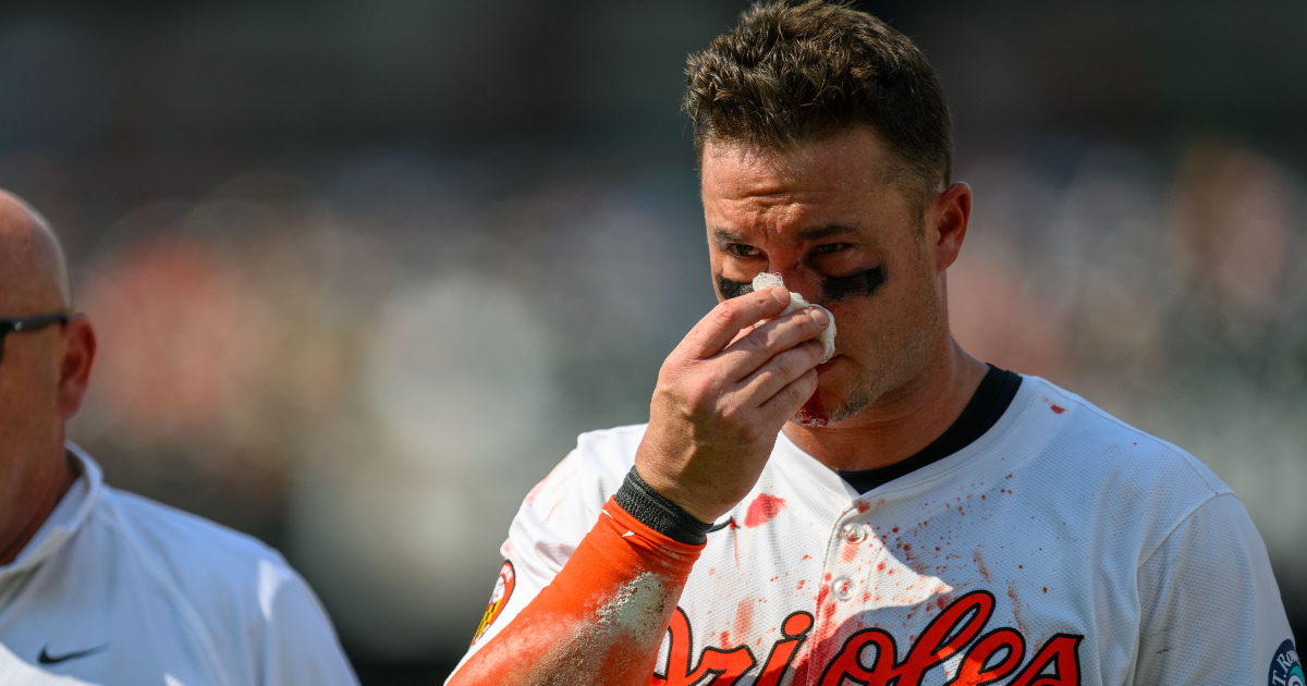 James McCann drilled with pitch to the face, stays in game despite ...